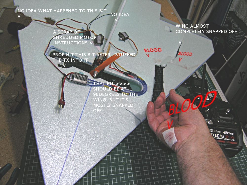 It's Injury Time!!! - All Things Model Flying - RCM&E Home of Model ...
